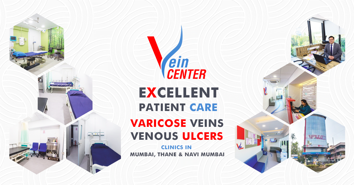Asia's #1 VenaSeal Varicose Veins Clinic in Mumbai - The Vein Center Mumbai