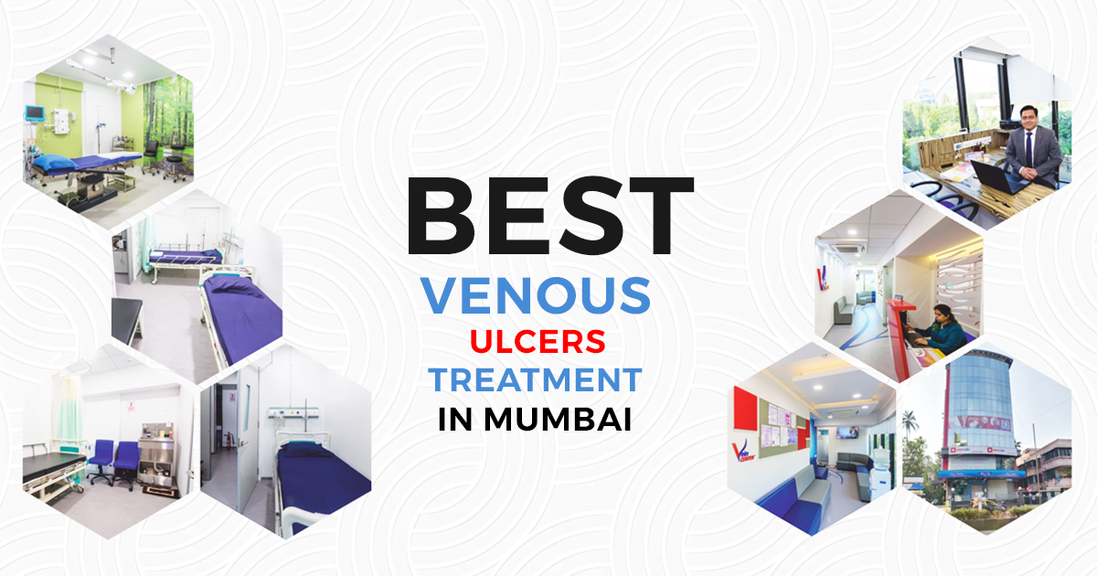 Best Venous Ulcers Treatment in Mumbai at #1 Clinic - The Vein Center ...